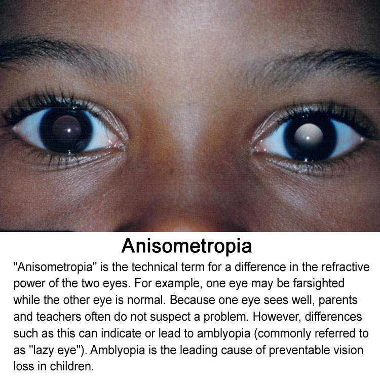 Documents | Vision Research Corporation